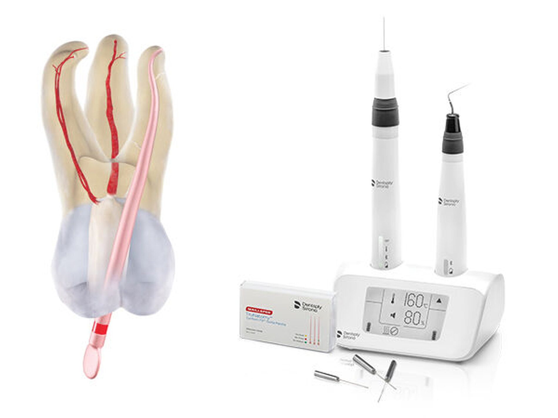 Smart zur warm-vertikalen Obturation - zm-online