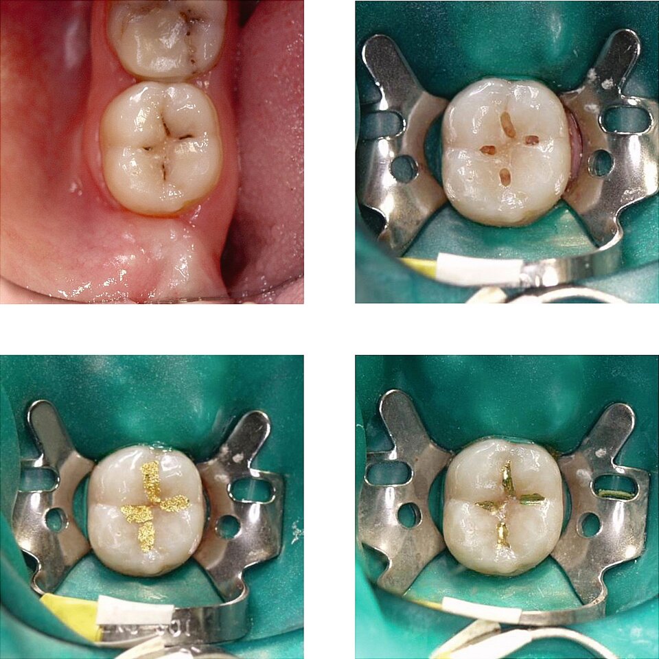 Der Glanz der alten Technik - zm-online