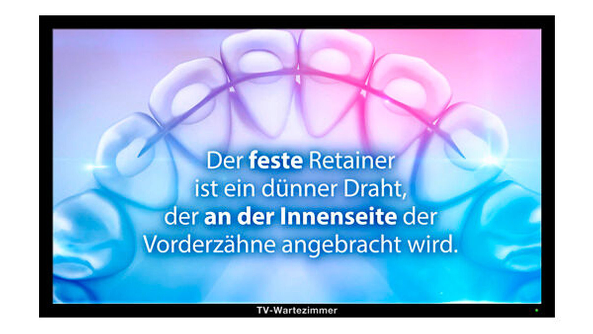 TV-Wartezimmer: Neue Filme erklären Retainer-Einsatz - zm-online