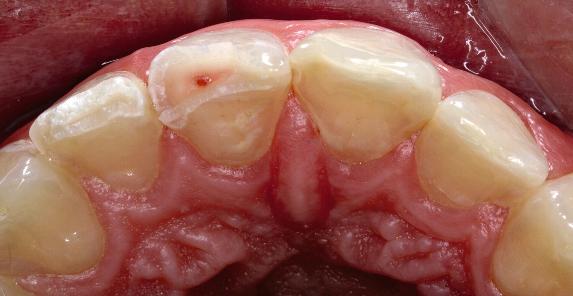 Endodontische Aspekte - zm-online