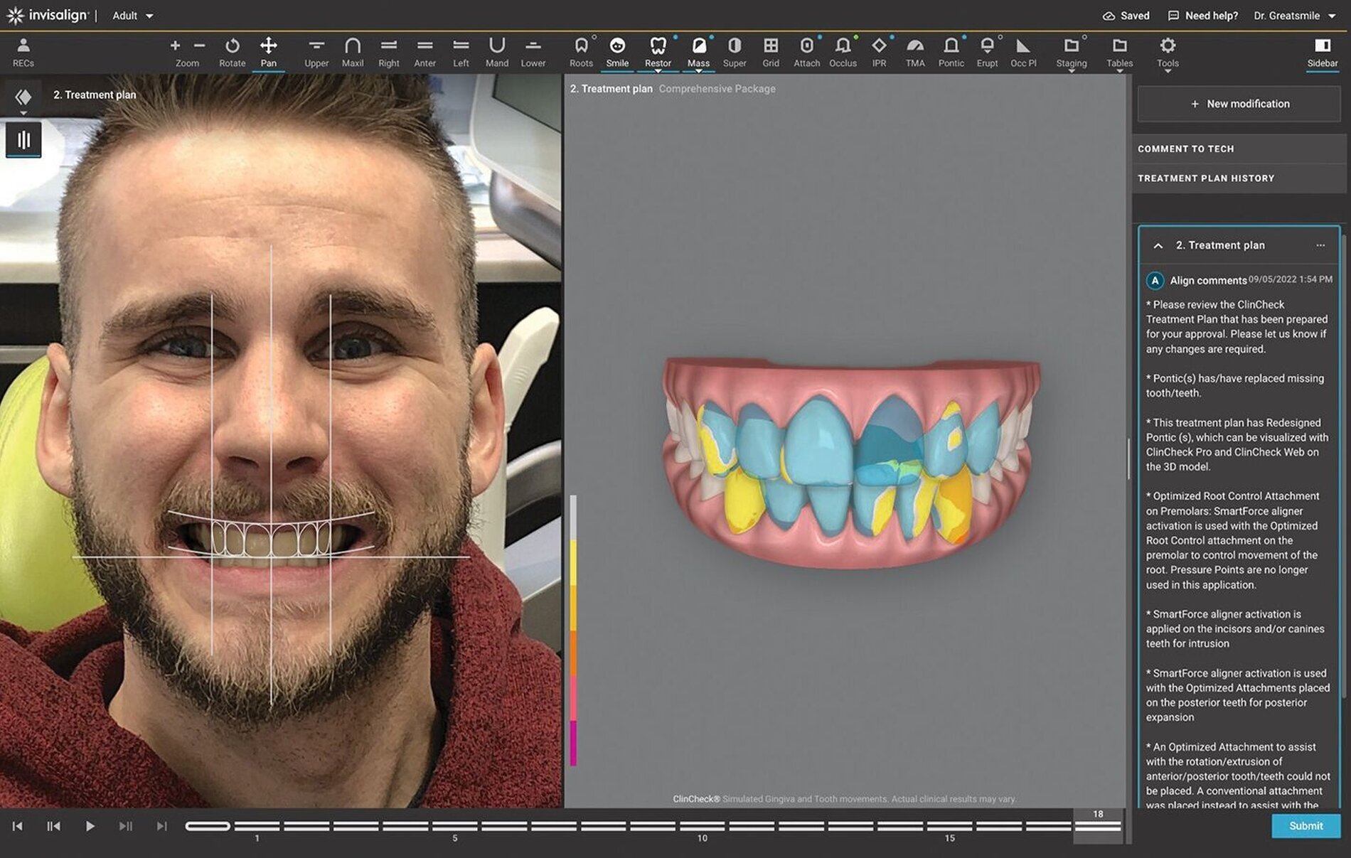 Launch der Invisalign Smile Architect Software - zm-online