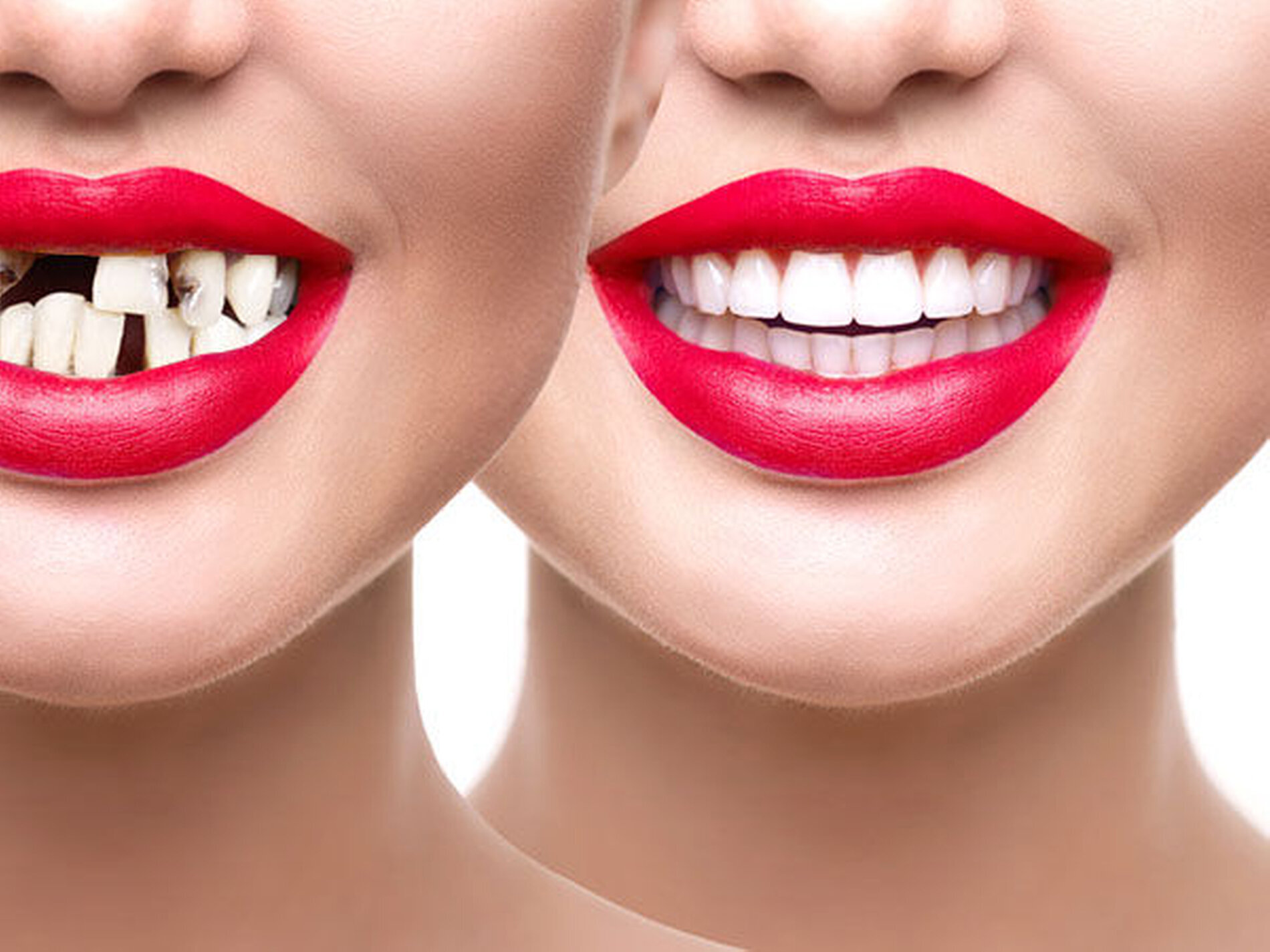 Prosecco-Smile bedroht Briten - zm-online