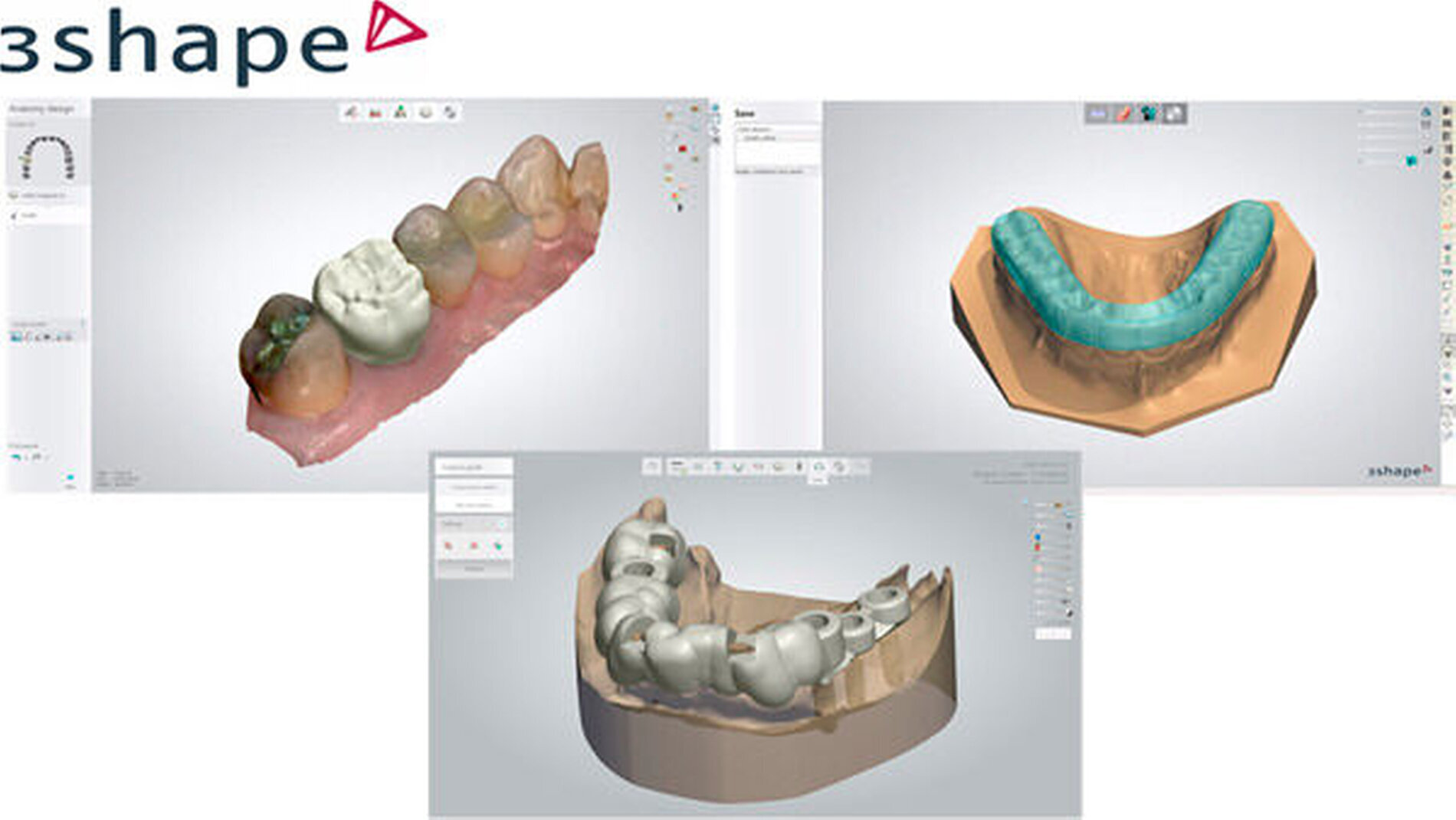3Shape: Neues Dental System 2014 - zm-online