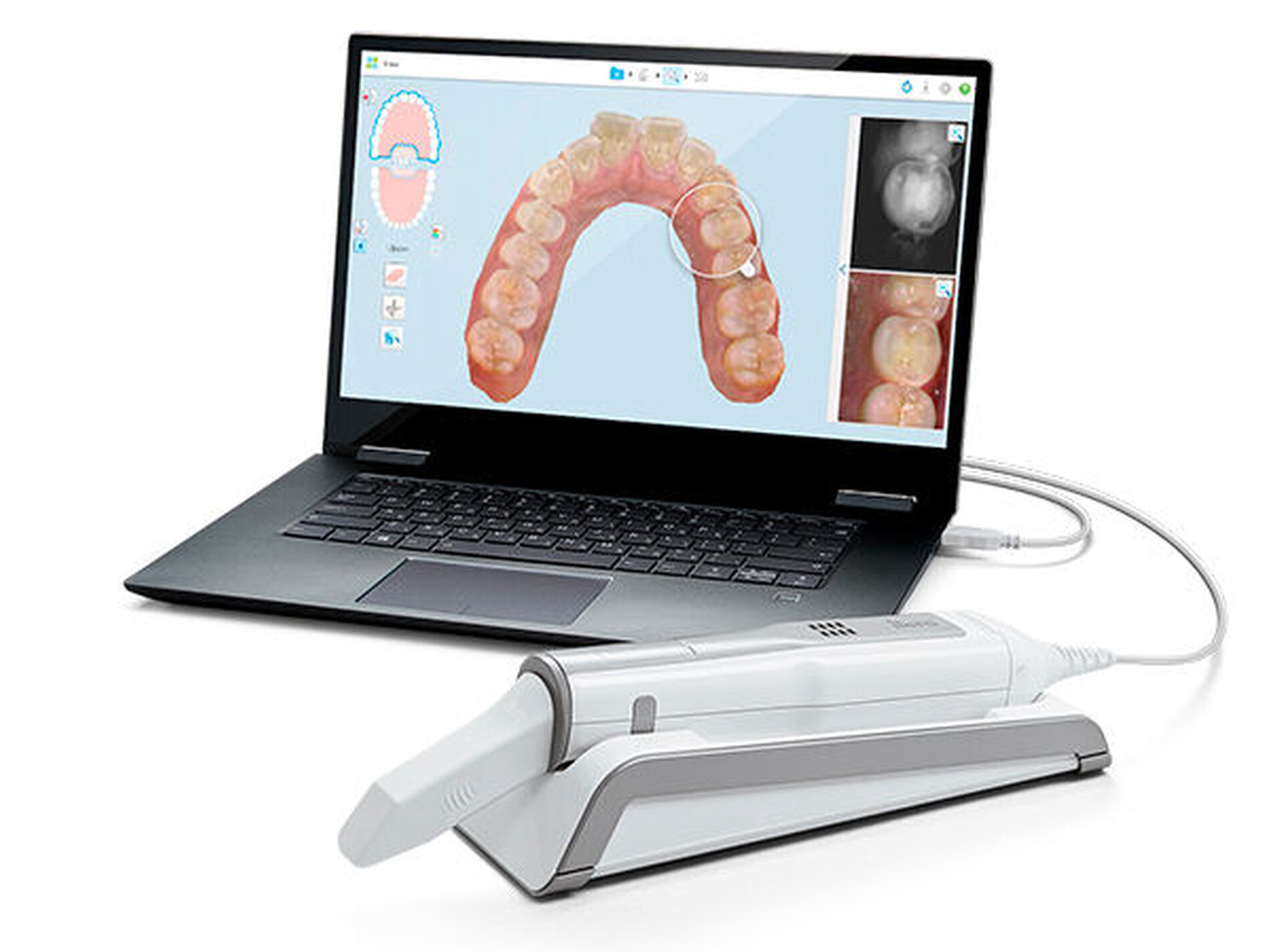 Intraoralscanner mit innovativen Funktionen für volldigitalen ...