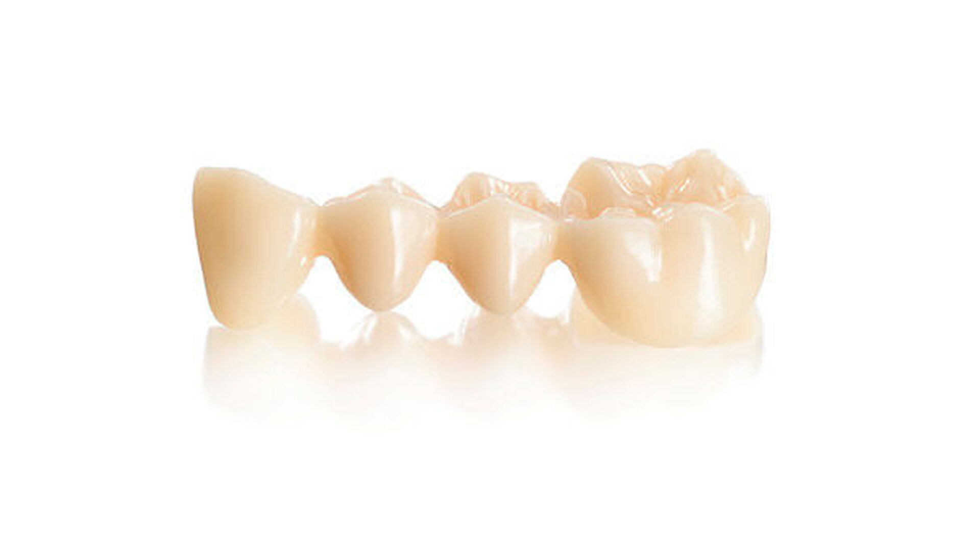 Chipping Adé: Lava Plus Zirkoniumoxid überzeugt auch ohne Verblendung ...