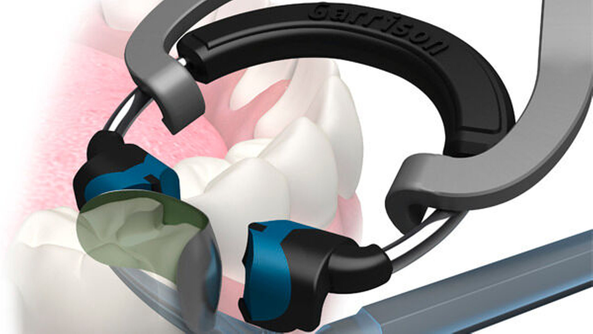 Garrison: Composi-Tight 3D XR Ring - zm-online