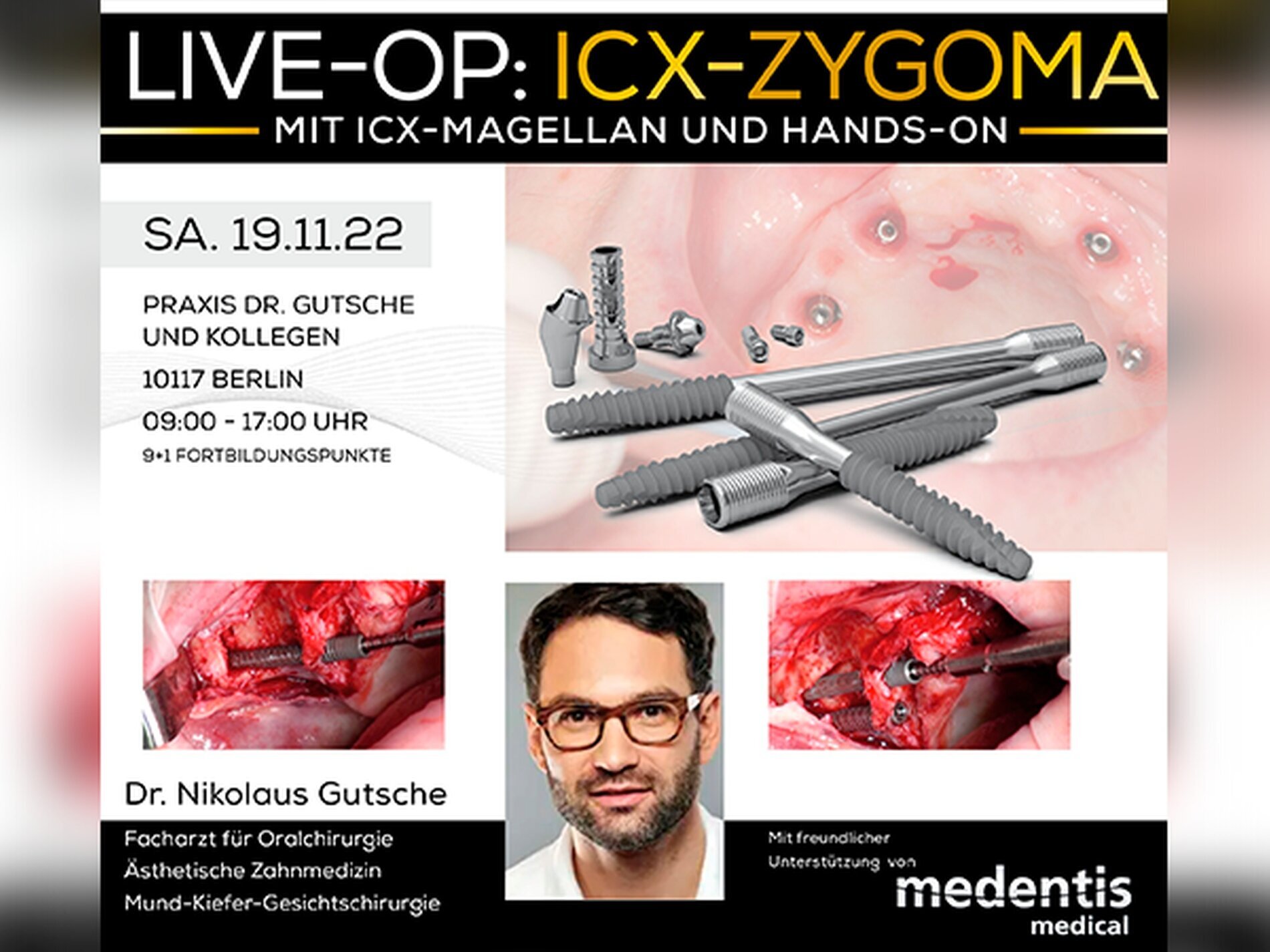 Live-OP: ICX-ZYGOMA – Mit ICX-MAGELLAN und Hands-On - zm-online