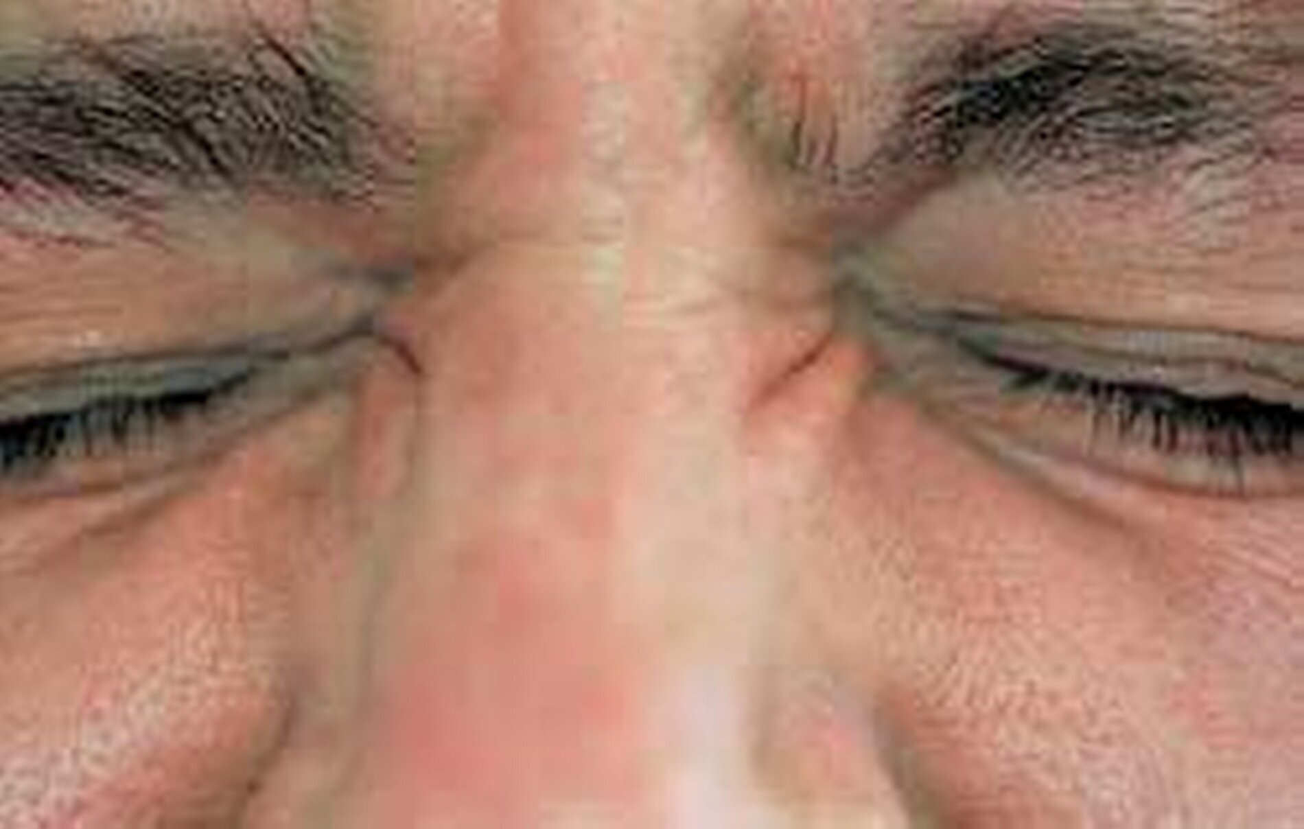 Nie wieder Falten und mehr! - zm-online