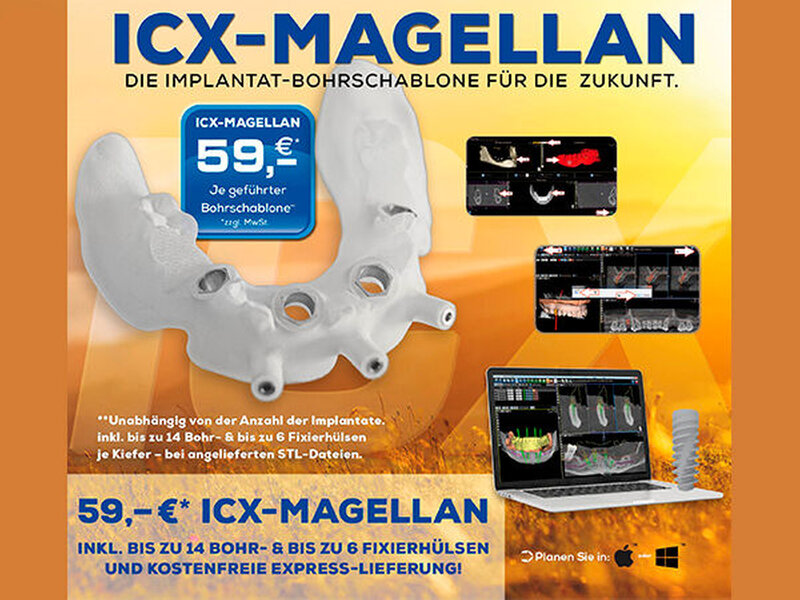ICX-MAGELLAN: In wenigen Schritten von der Planung zur Implantation - zm-online
