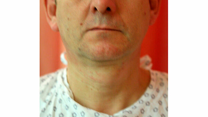 Mediane Halszyste - zm-online