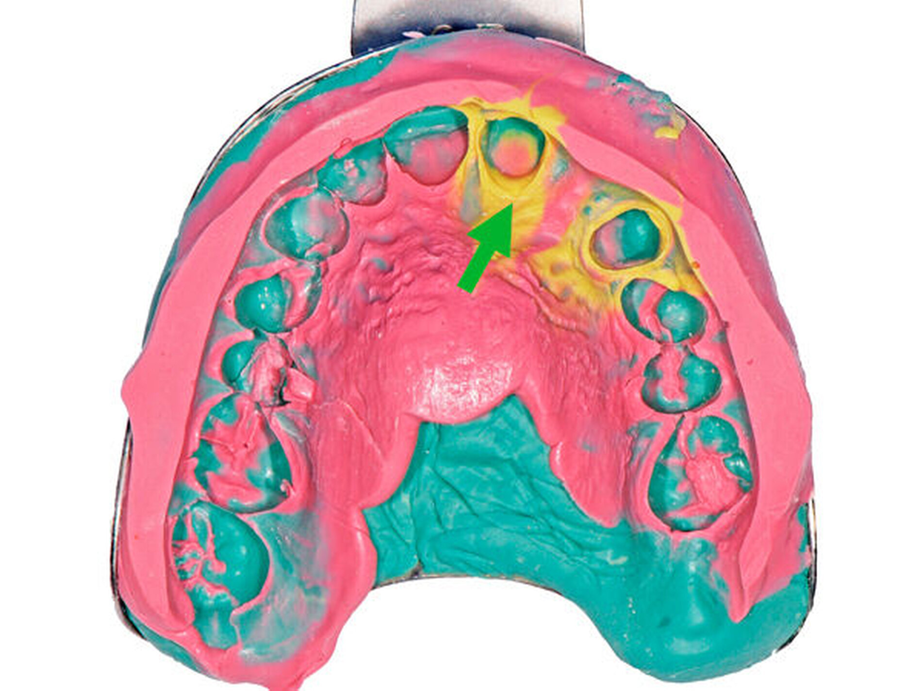 Ist die konventionelle Abformung obsolet? - zm-online