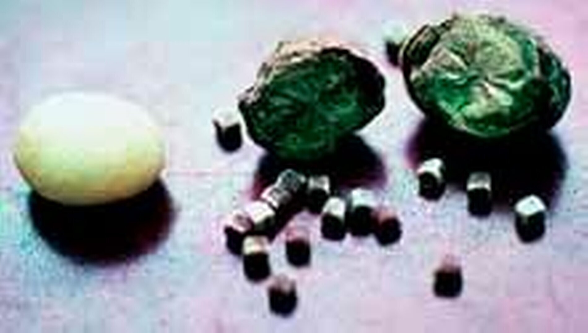 Die Gallensteine - zm-online