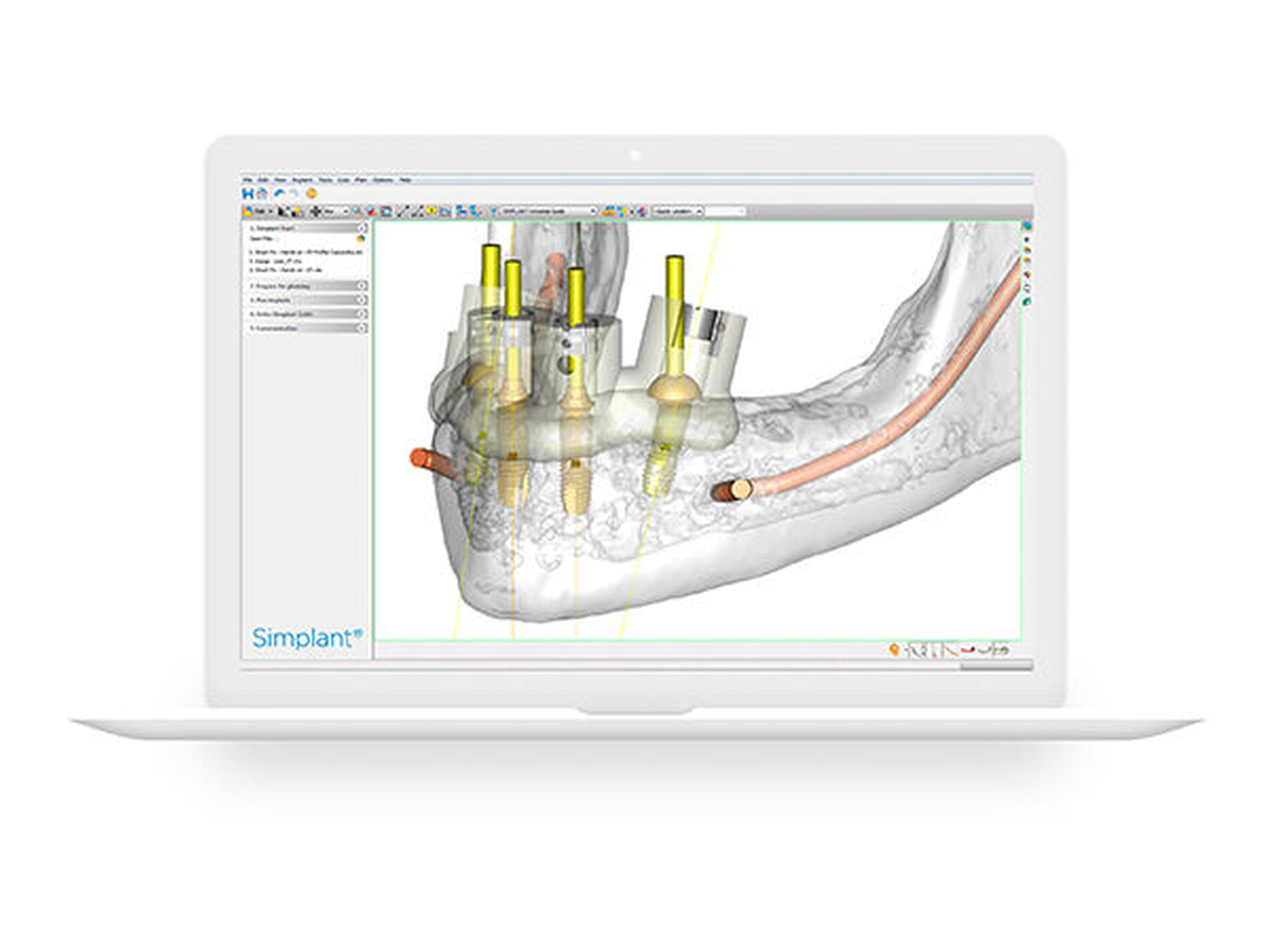 Die neue Software-Generation - zm-online