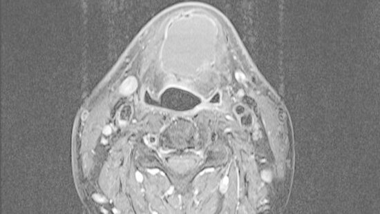 Mediane Halszyste - zm-online