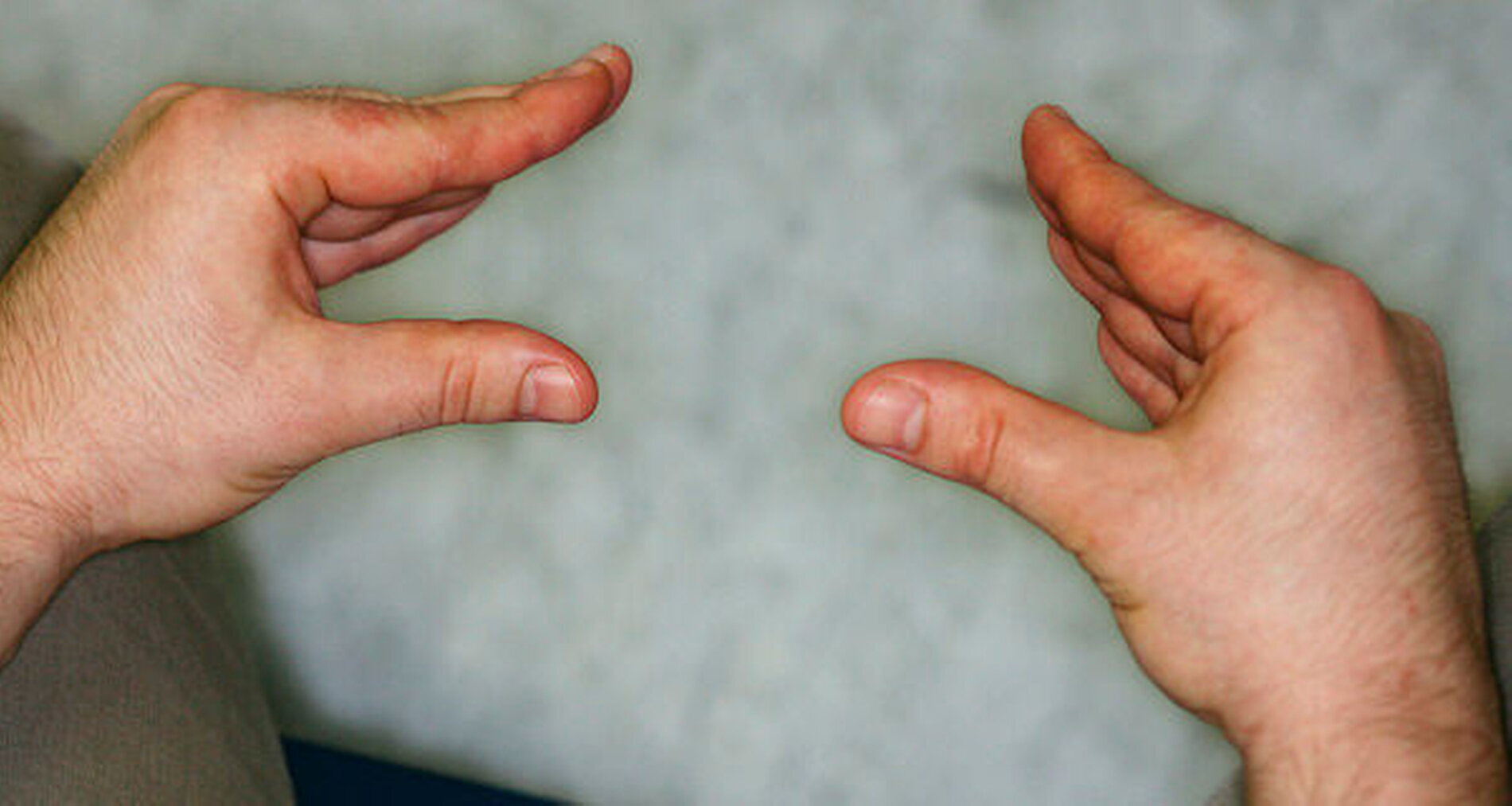 Die Hyperventilation - zm-online