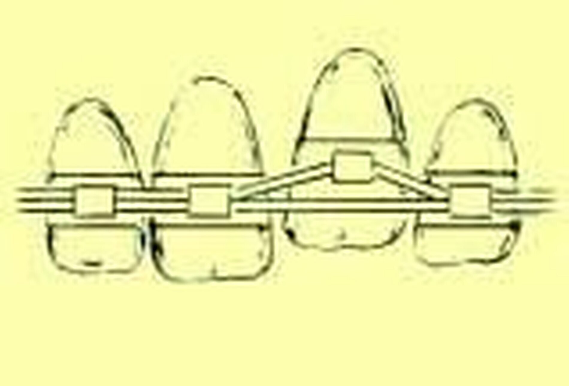 Die Entwicklung der festsitzenden Apparatur - zm-online