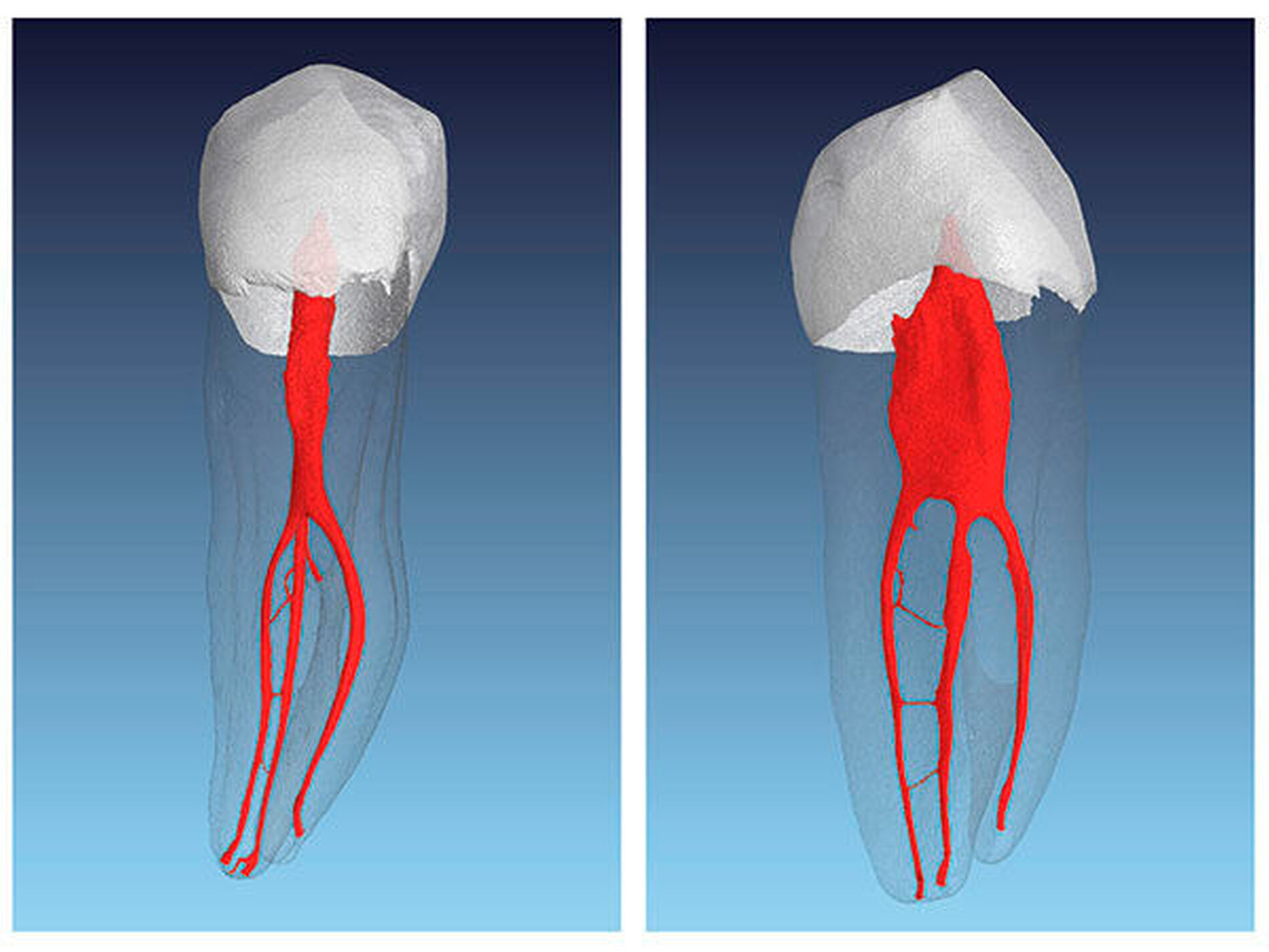Die Anatomie von Unterkiefer-Prämolaren - zm-online