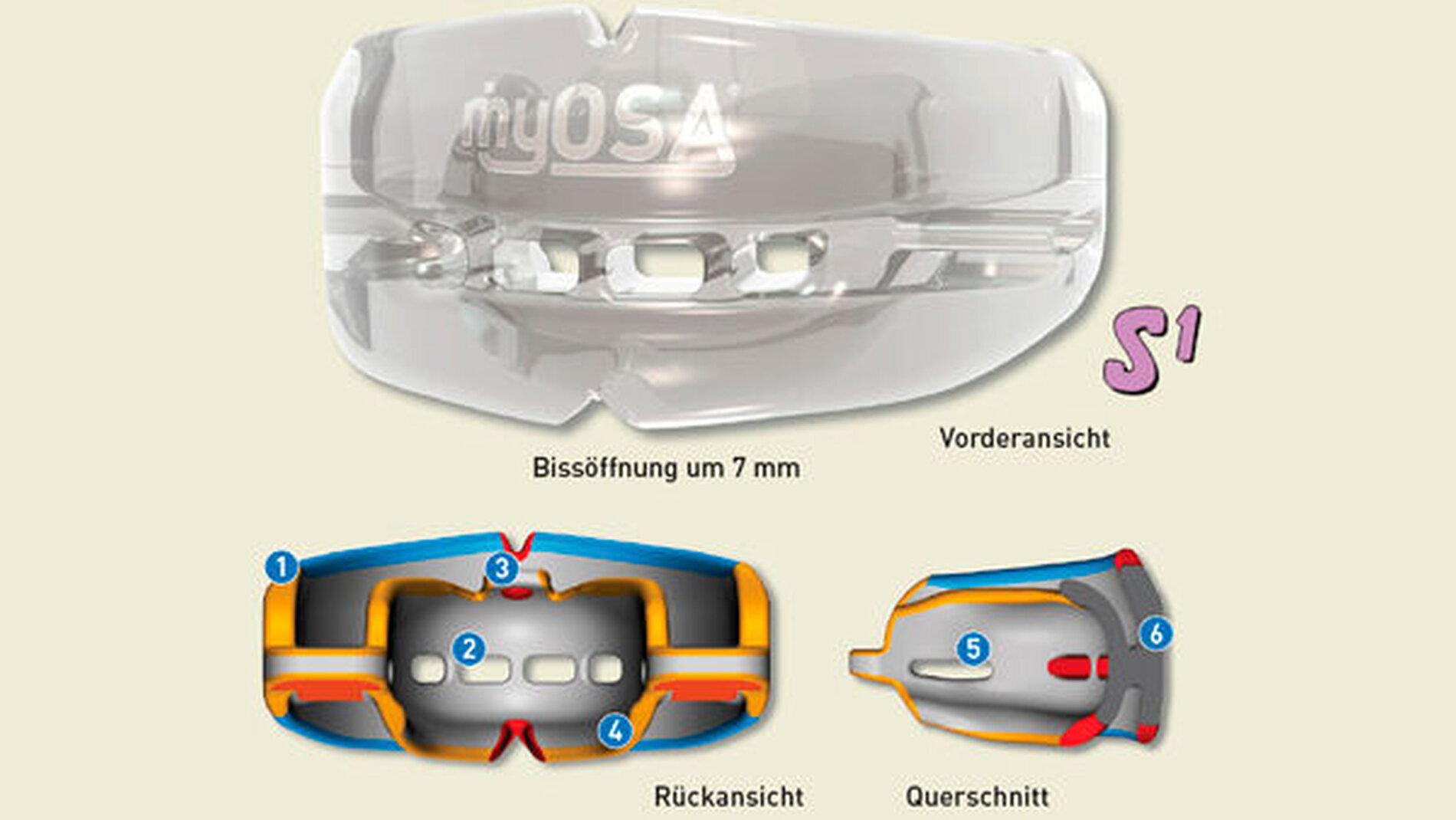 myOSA: Myofunktionelle Therapie von Schlafstörungen - zm-online
