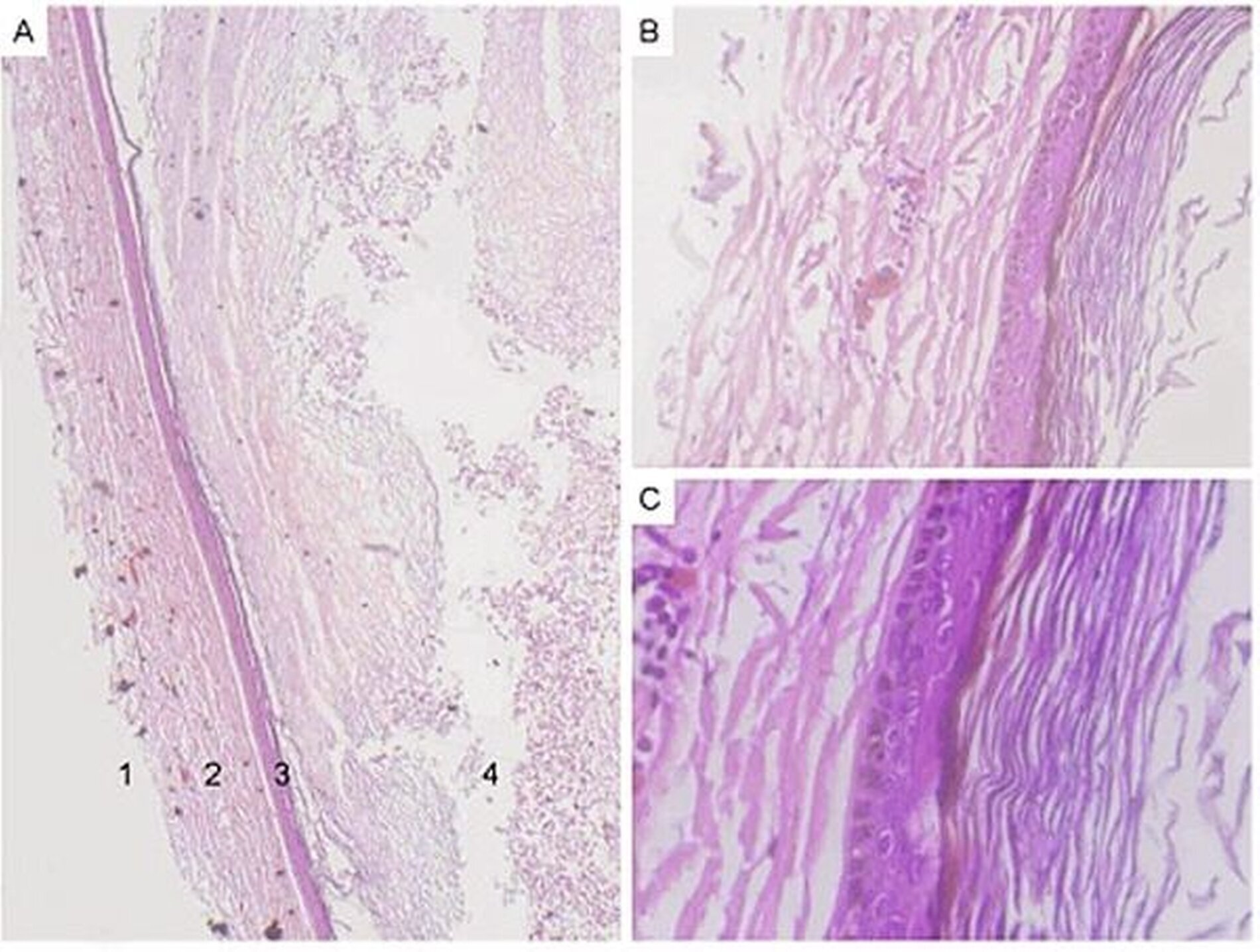 Atherom der Wange - zm-online