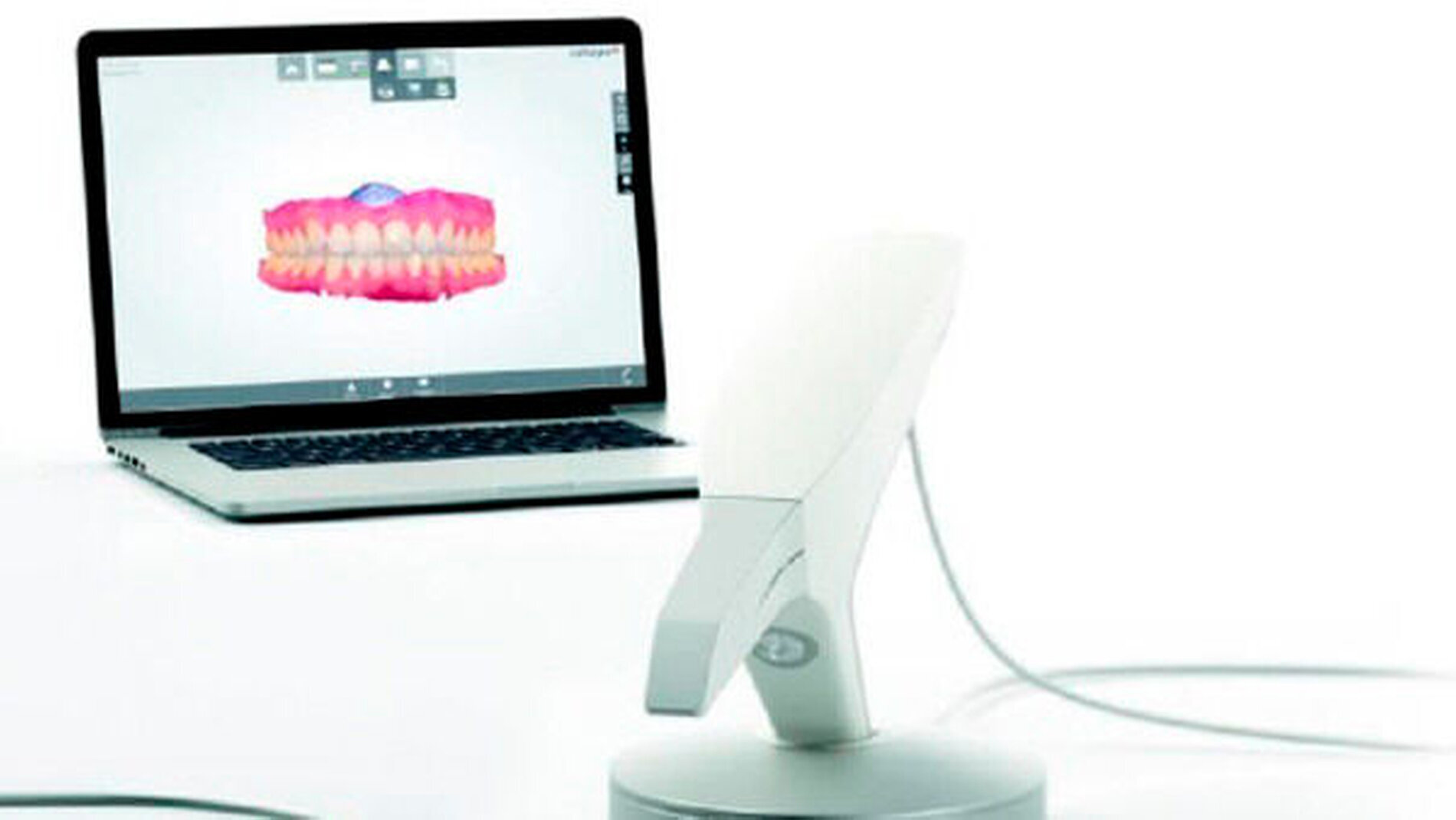 3Shape: Trios-System zugelassen für SimpliClear-Lösung - zm-online