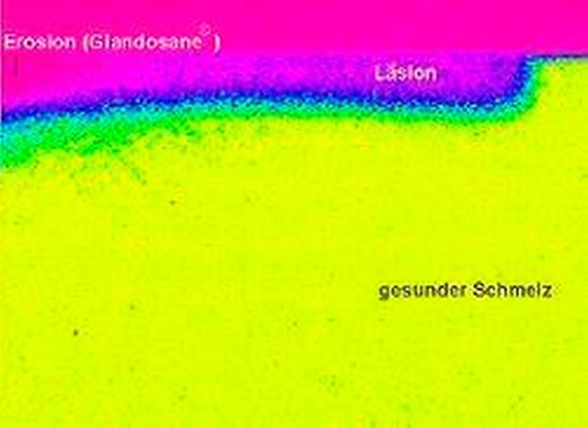 Speichelersatzmittel zur Behandlung der Hyposalivation - zm-online