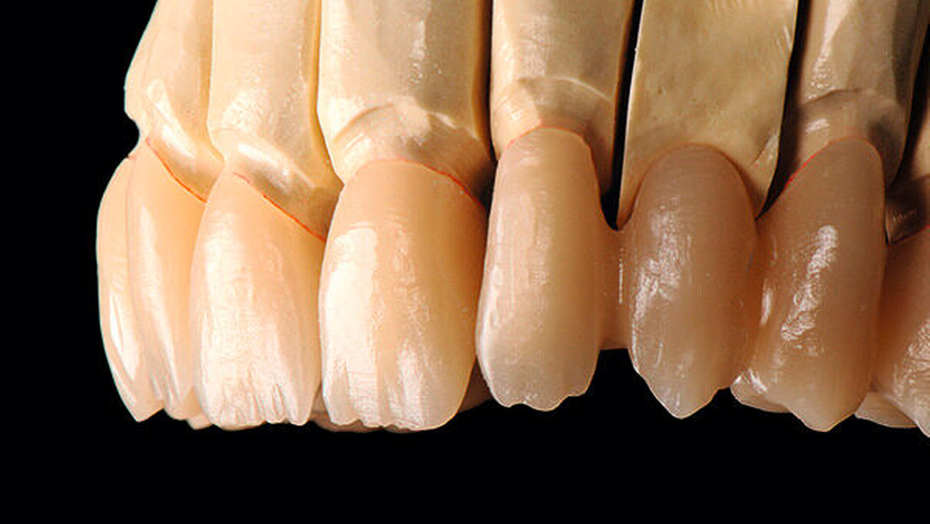 Das Dentin bestimmt die Farbe - zm-online