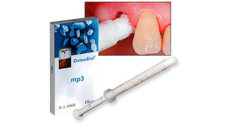 OsteoBiol: Hydroxylapatit mit integriertem Kollagen - zm-online