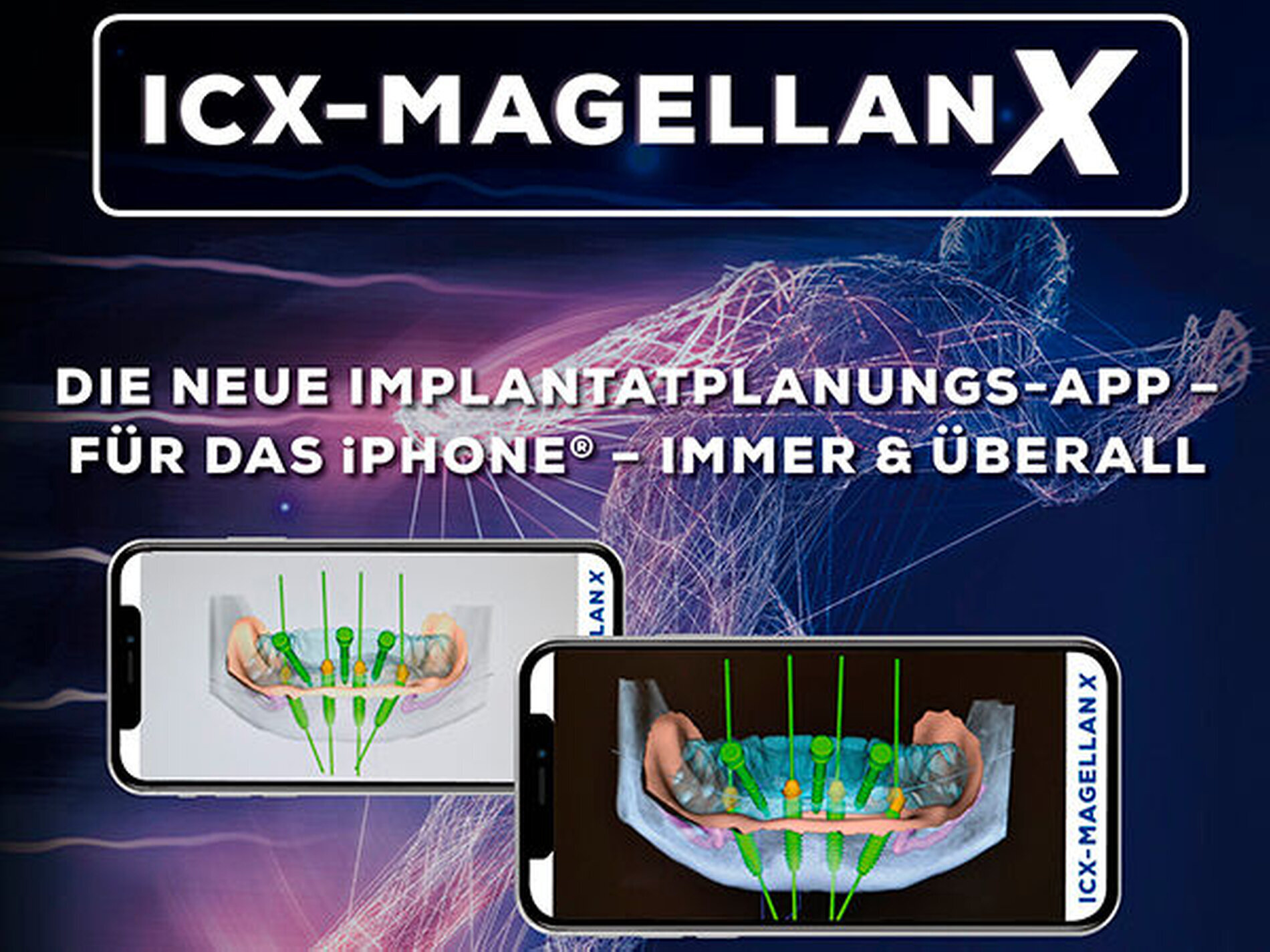 Implantatplanungs-App ICX-MAGELLAN X - zm-online
