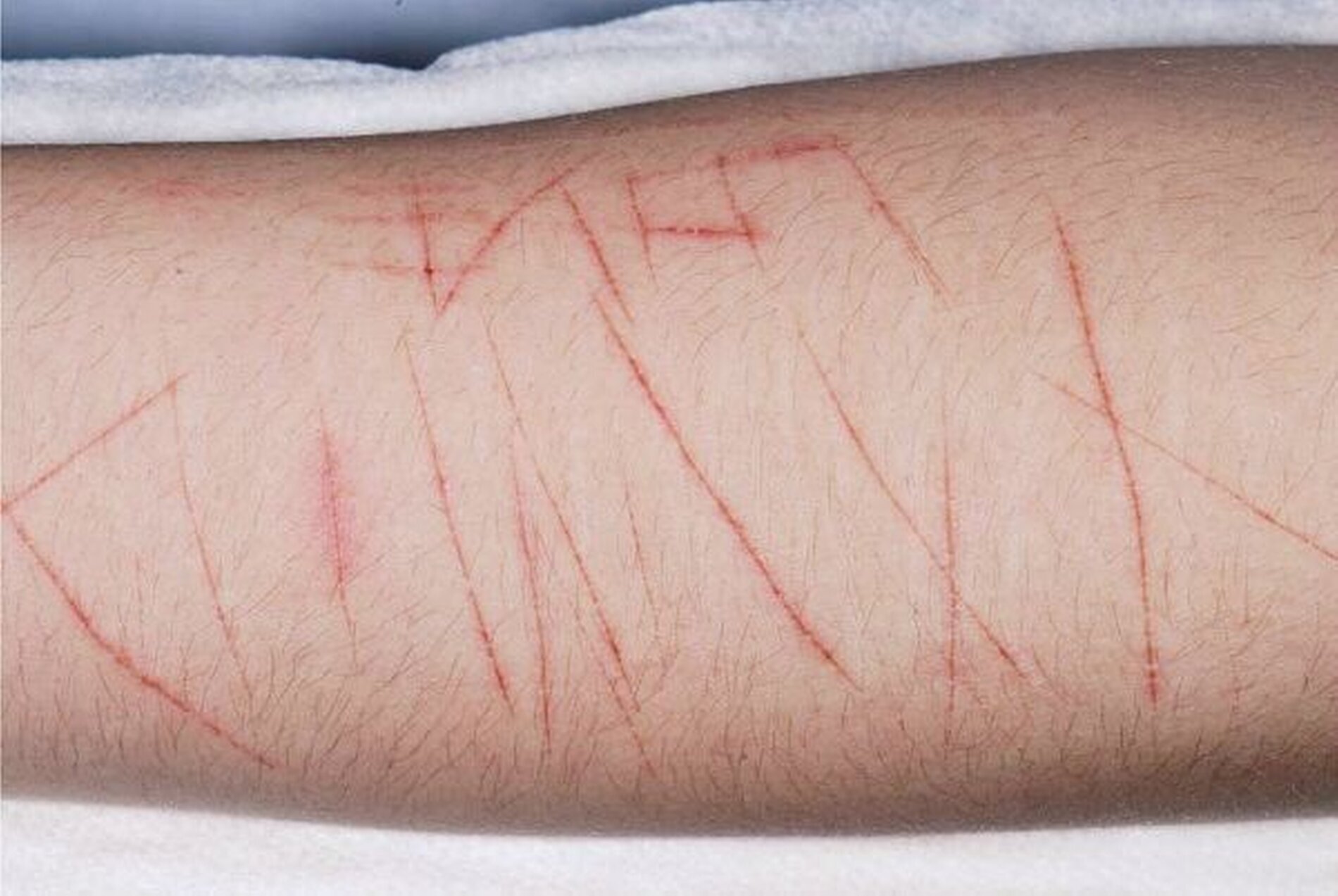 Selbstverletzung im Gesicht - zm-online