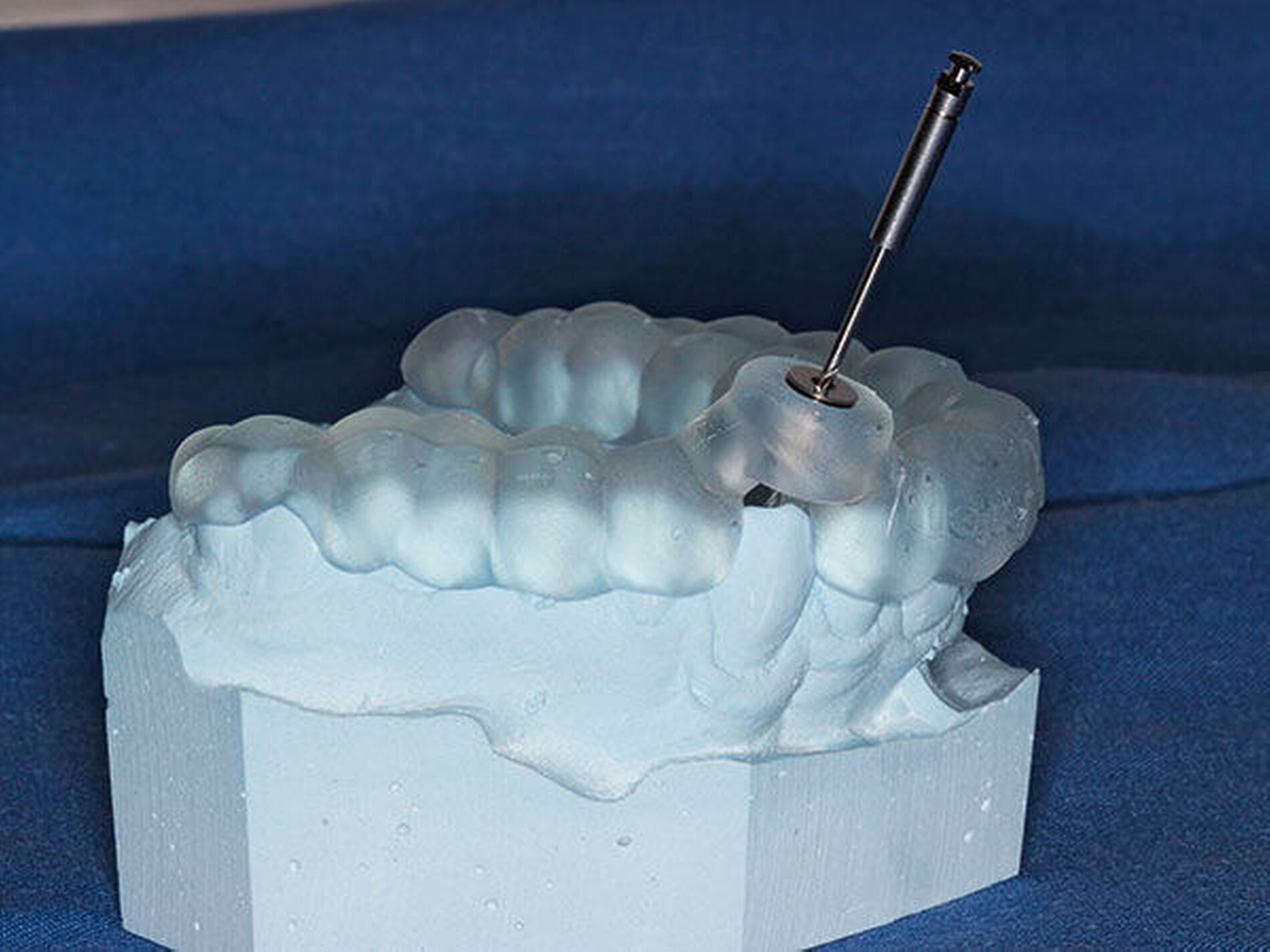 Guided Endodontics - zm-online