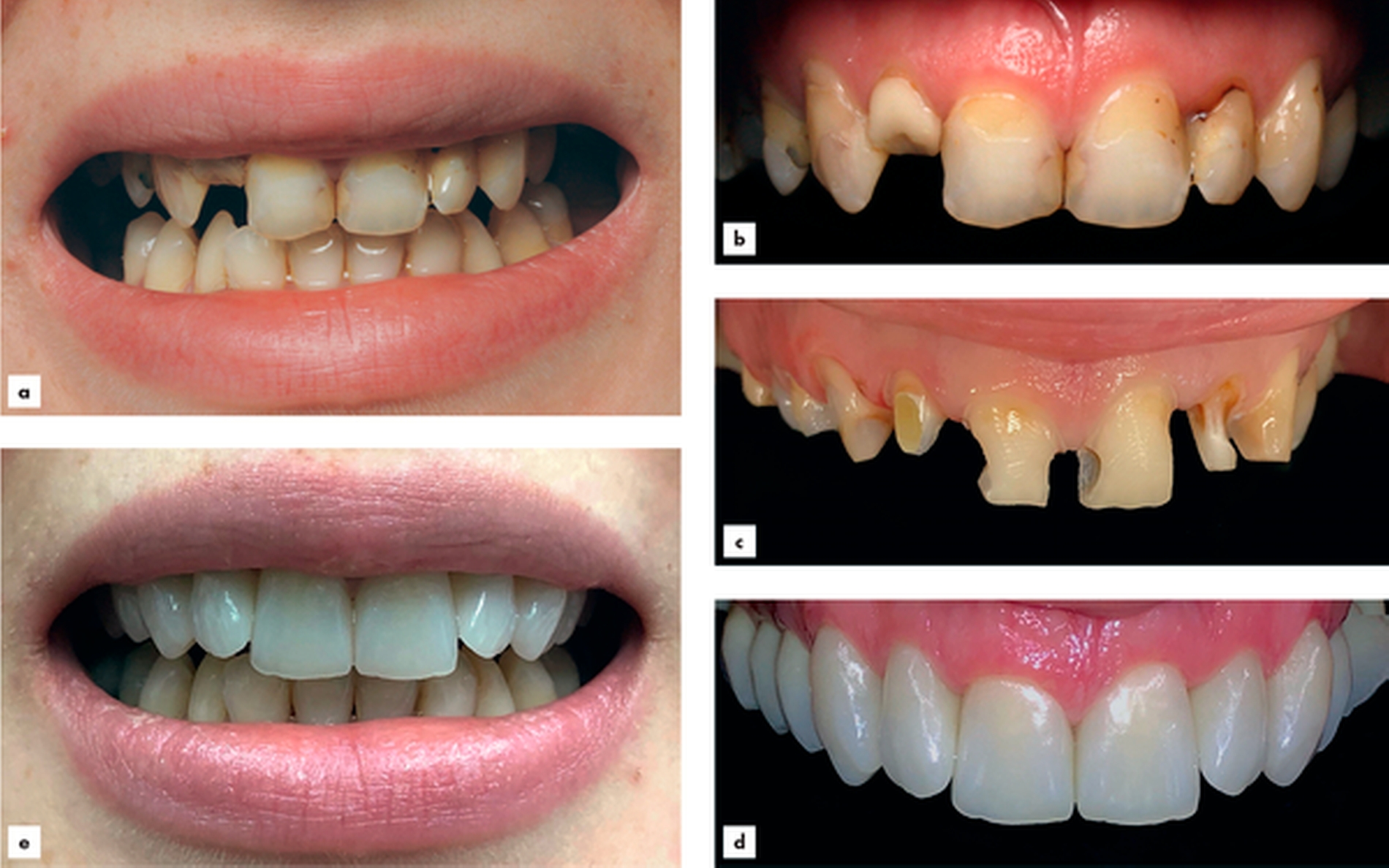 Welche Risikofaktoren den Langzeiterfolg beeinflussen - zm-online